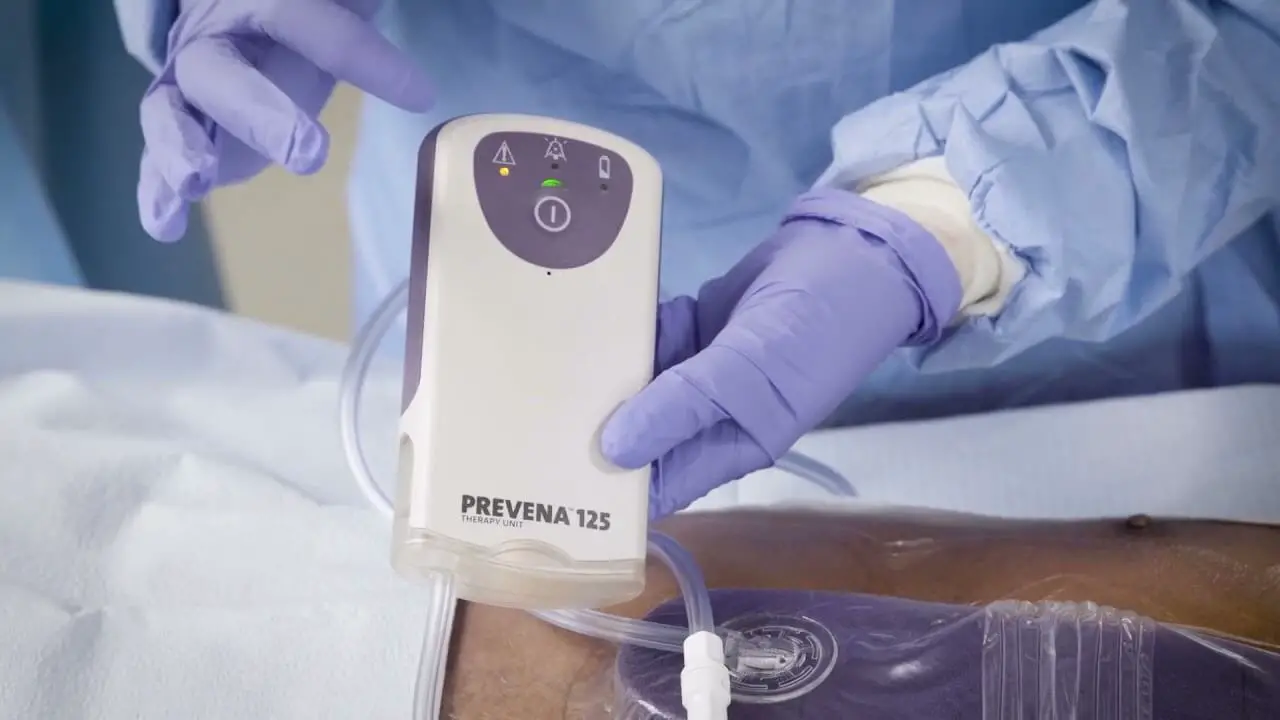 Prevena Plus 125 Troubleshooting: Mastering Quick Fixes